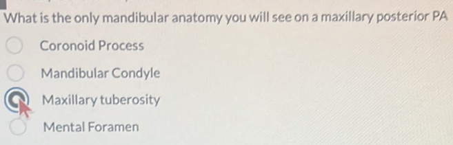 What Is the Only Mandibular Anatomy You Will See on a Maxillary ...