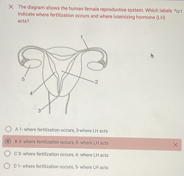 X The Diagram Shows the Human Female Reproductive System. Which Labels ...
