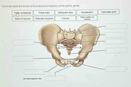 Correctly Label the Bones and Anatomical Features of the Pelvic Girdle ...