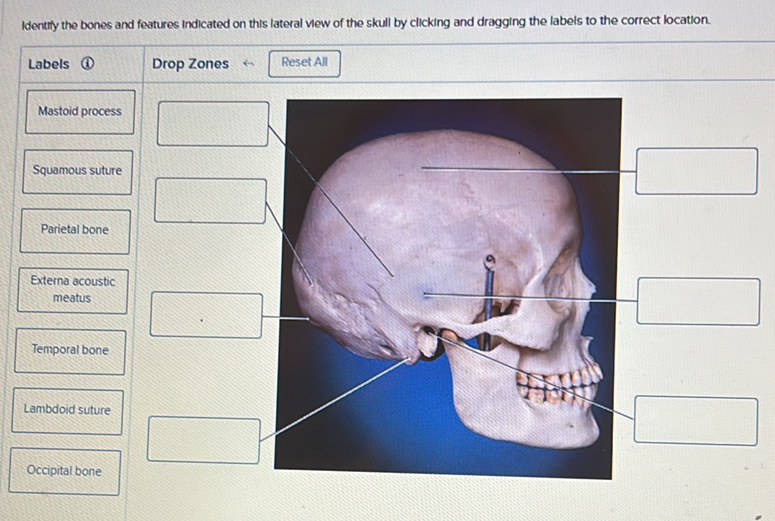 Identify the Bones and Features Indicated on This Lateral View of the Skull by Clicking and ...