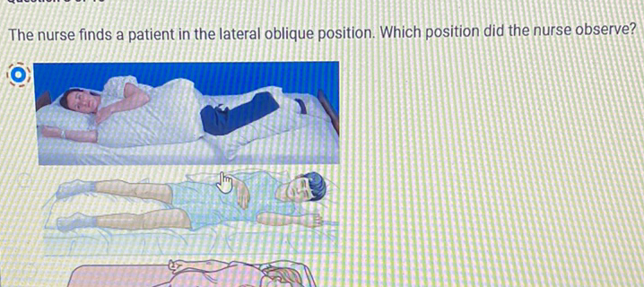 The Nurse Finds a Patient in the Lateral Oblique Position. Which ...